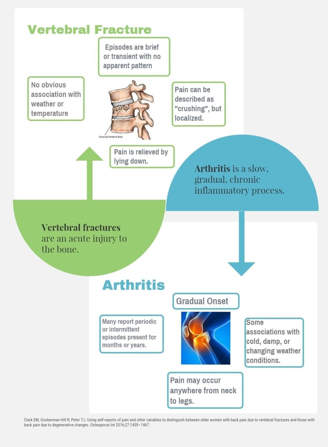 Arthritis Or Fracture Figuring Out What Back Pain Means Better Bones